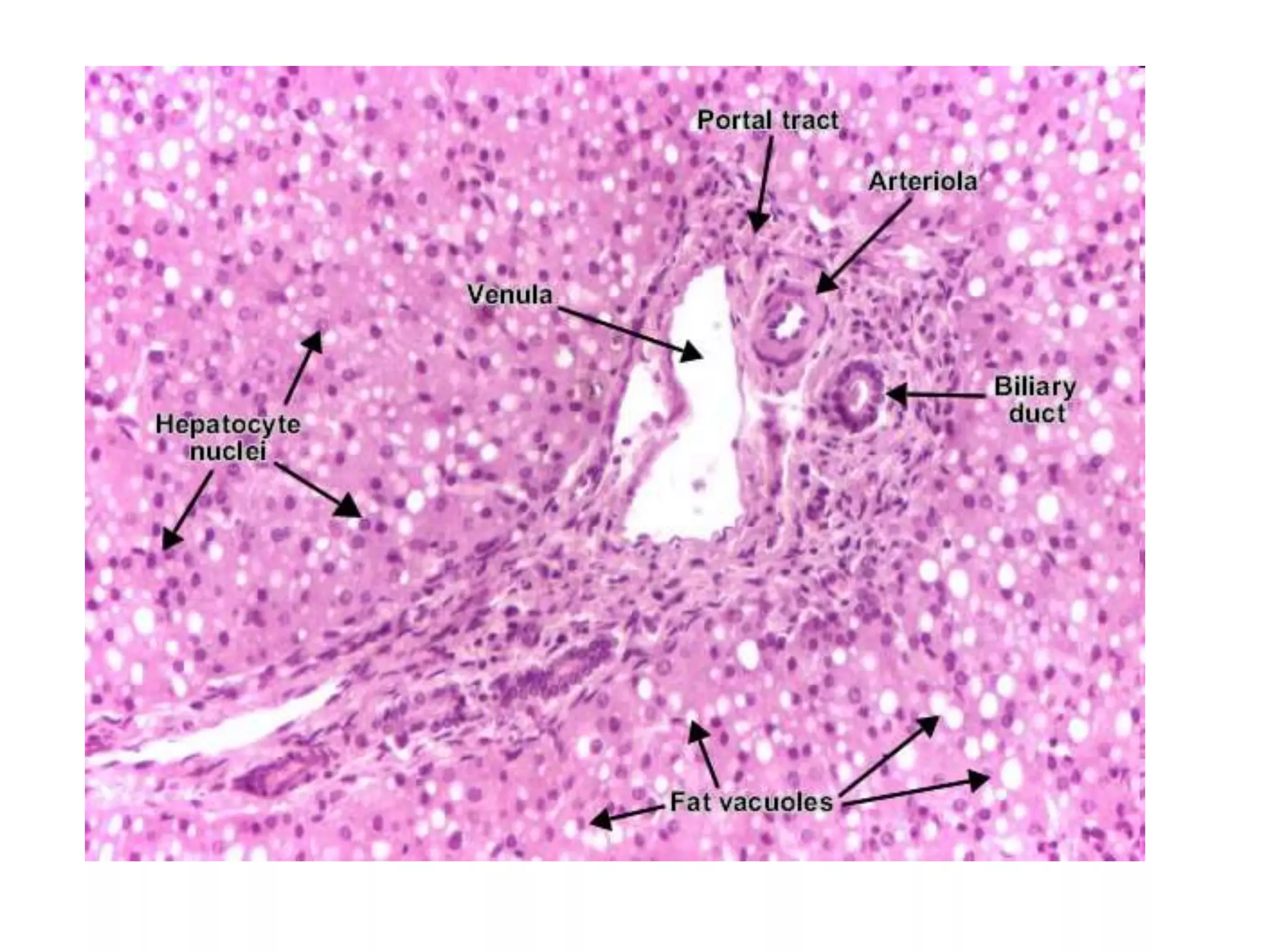 Cell injury : Intracellular accumulations | PPTX