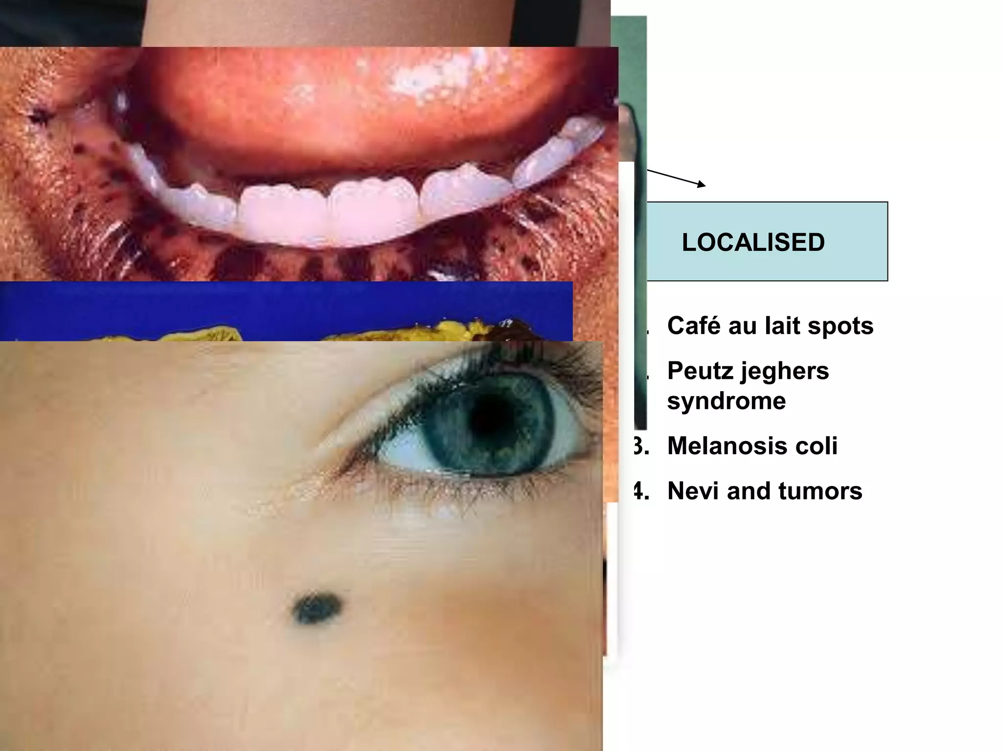 Cell injury : Intracellular accumulations | PPTX