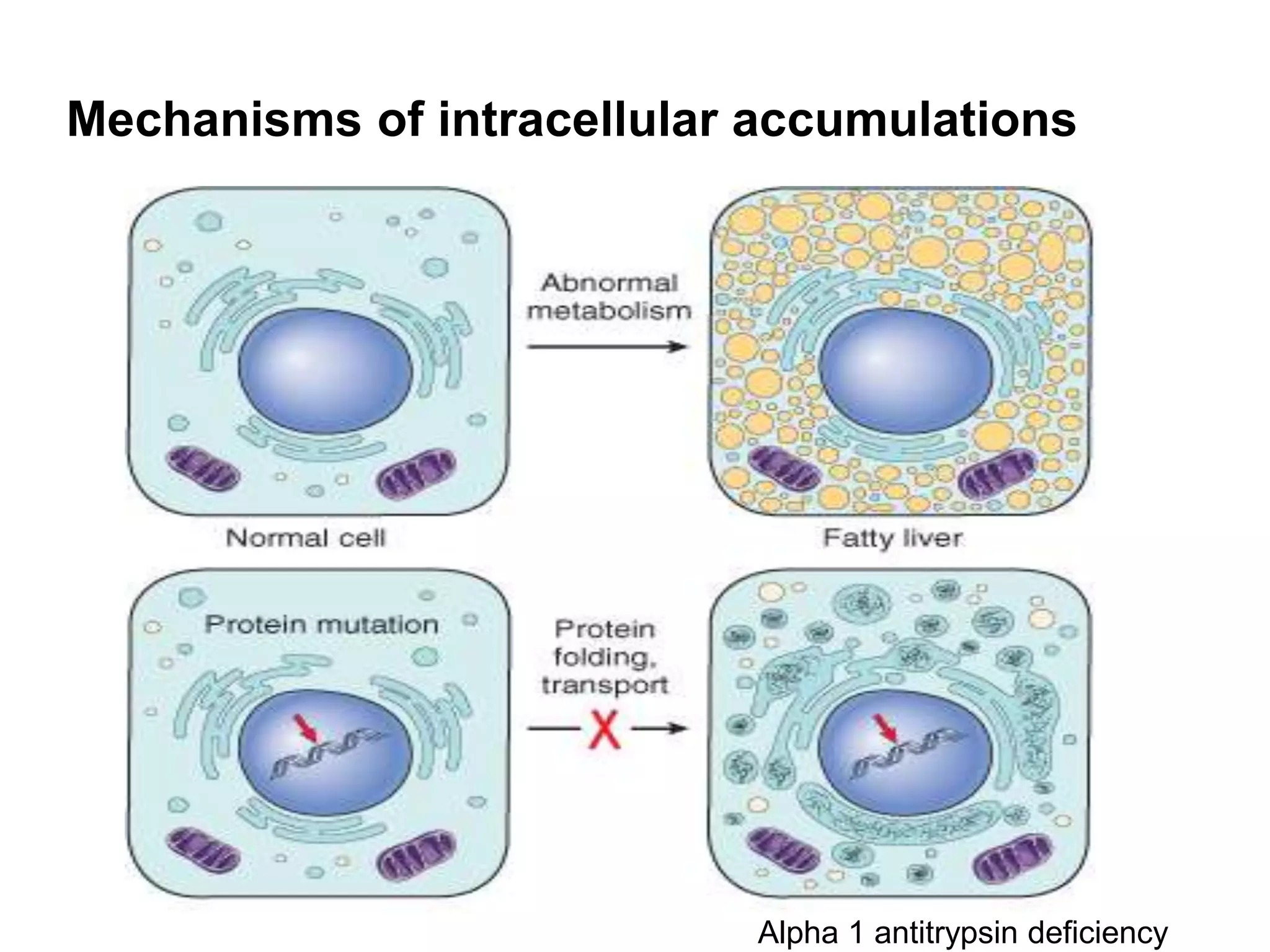 Cell injury : Intracellular accumulations | PPTX