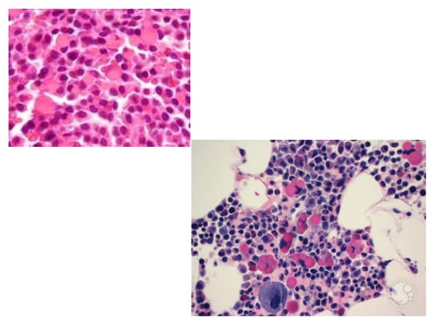 Cell injury : Intracellular accumulations | PPTX | Endocrine and ...