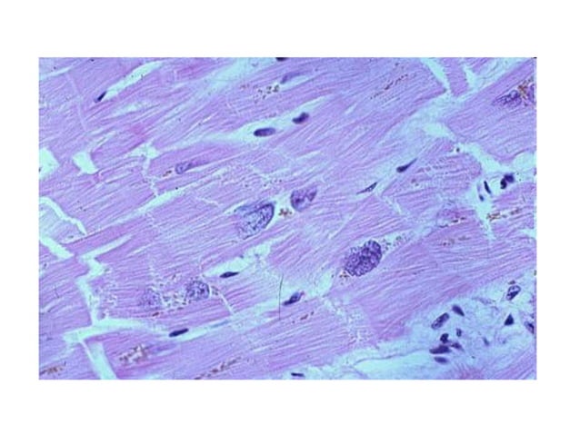 Cell injury : Intracellular accumulations | PPTX | Endocrine and ...