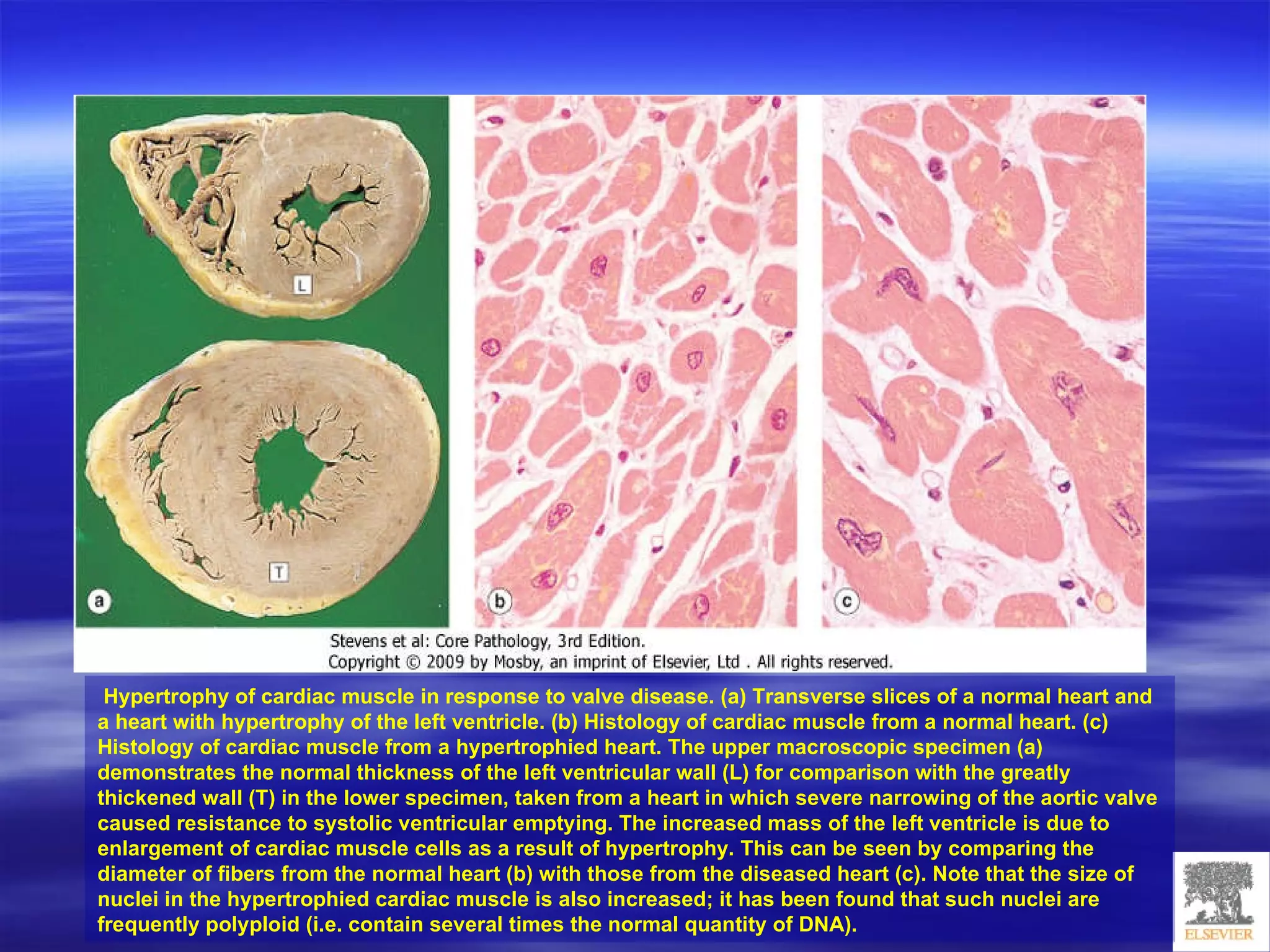 Cell Injury, Adaptation And Accumulations | PPT