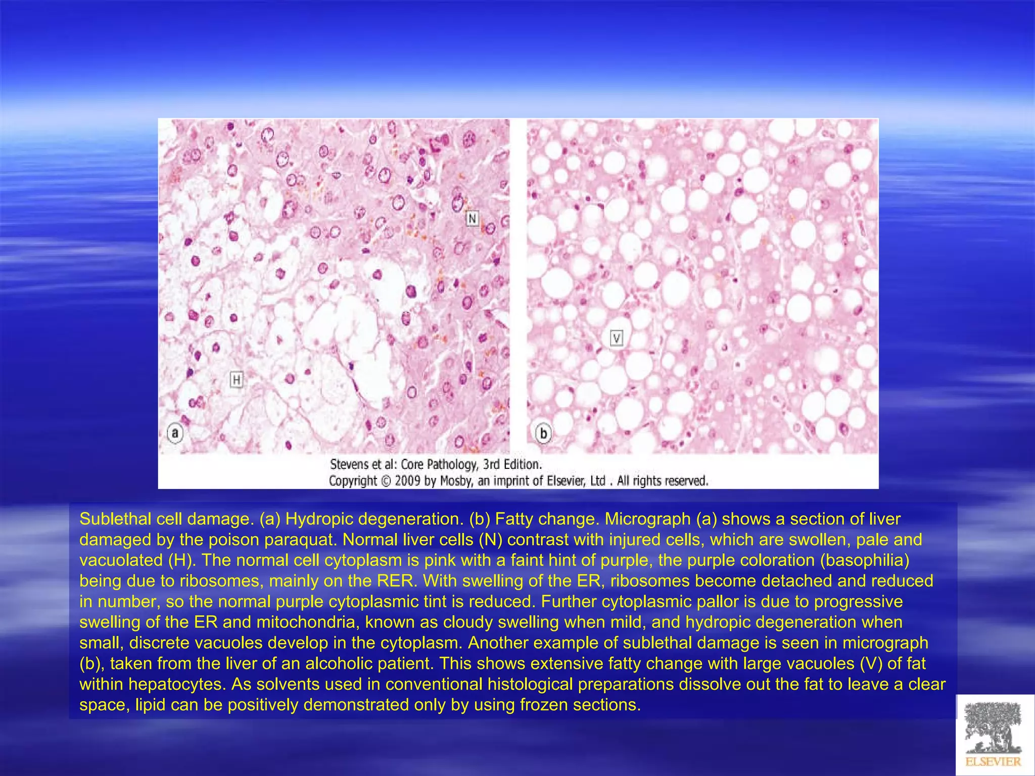 Cell Injury, Adaptation And Accumulations | PPT