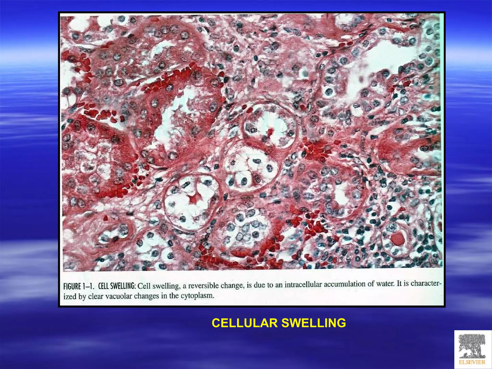 Cell Injury, Adaptation And Accumulations | PPT