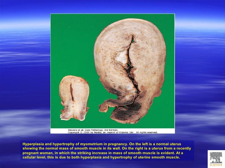 Cell Injury, Adaptation And Accumulations