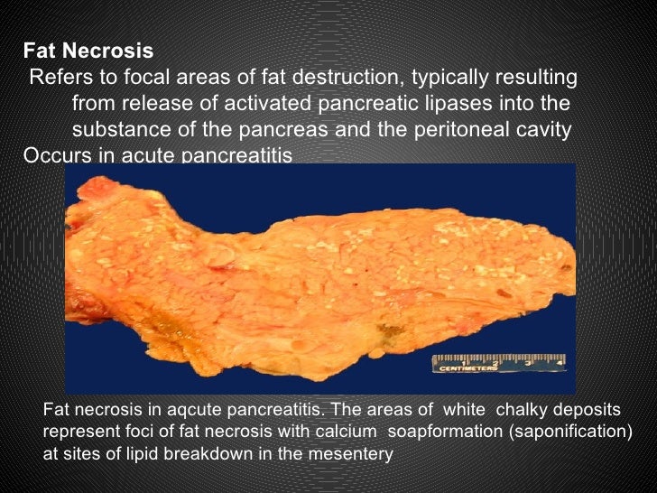 Cell injury, adaptation, and death fix