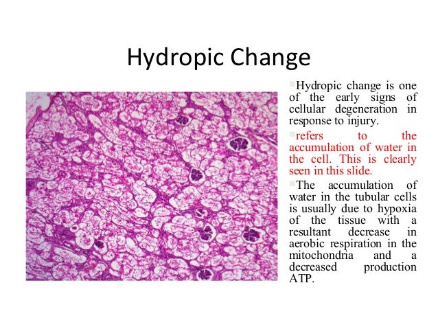 Cell injury adaptation class 1