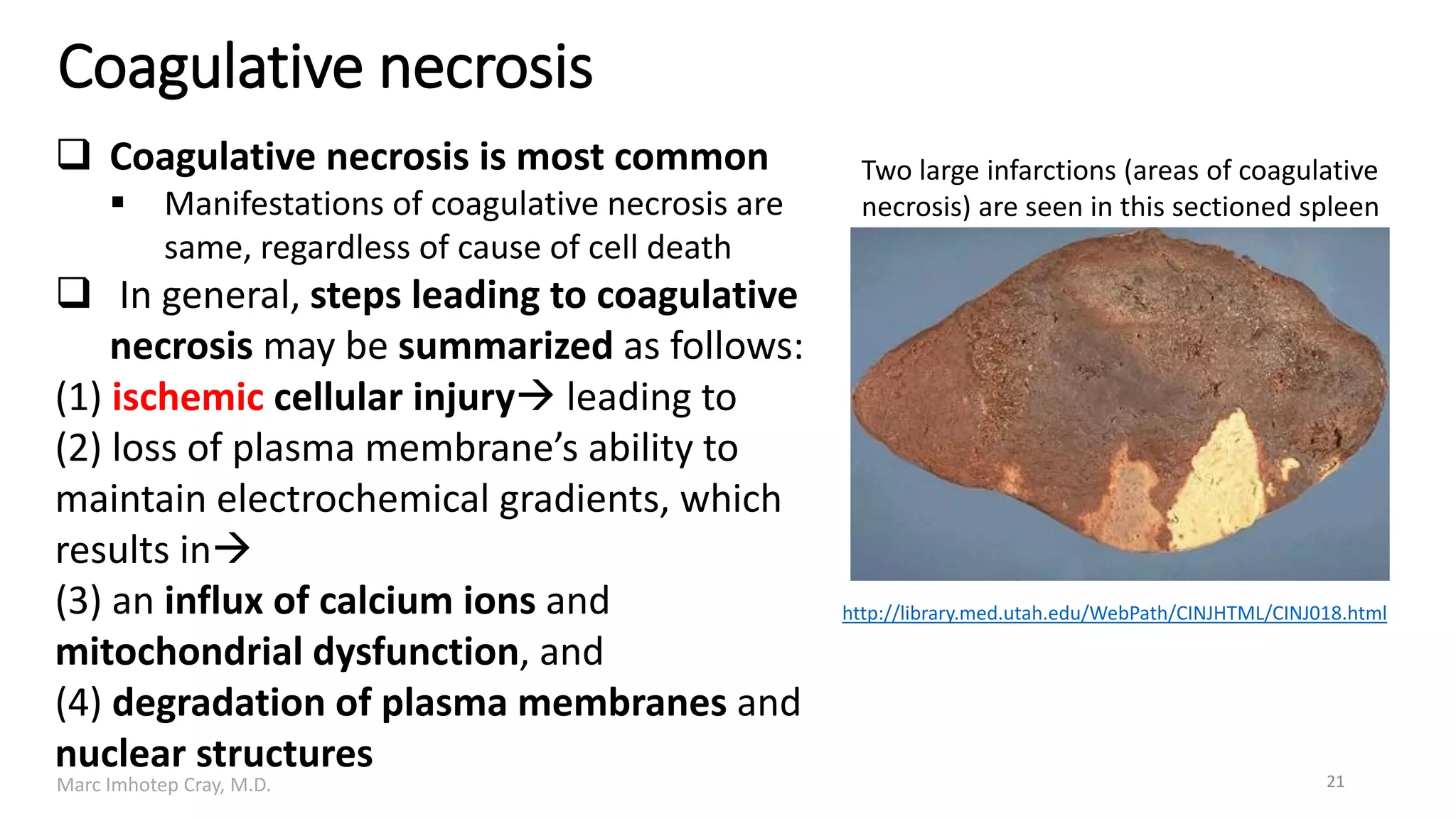 Cell Injury and Cell Death | PDF