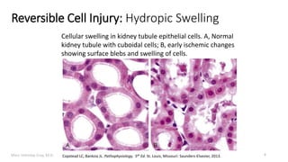 Cell Injury and Cell Death | PDF