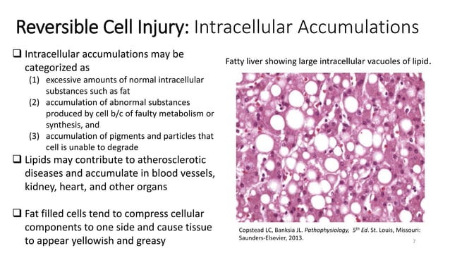 Cell Injury and Cell Death | PDF | Lung and Respiratory Health ...