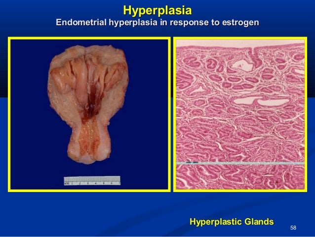 Cell injury and death, med., final 2011