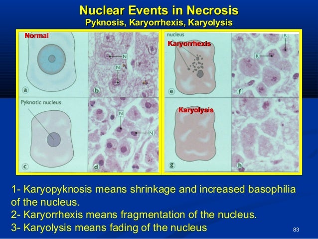 Cell injury and death, med., final 2011