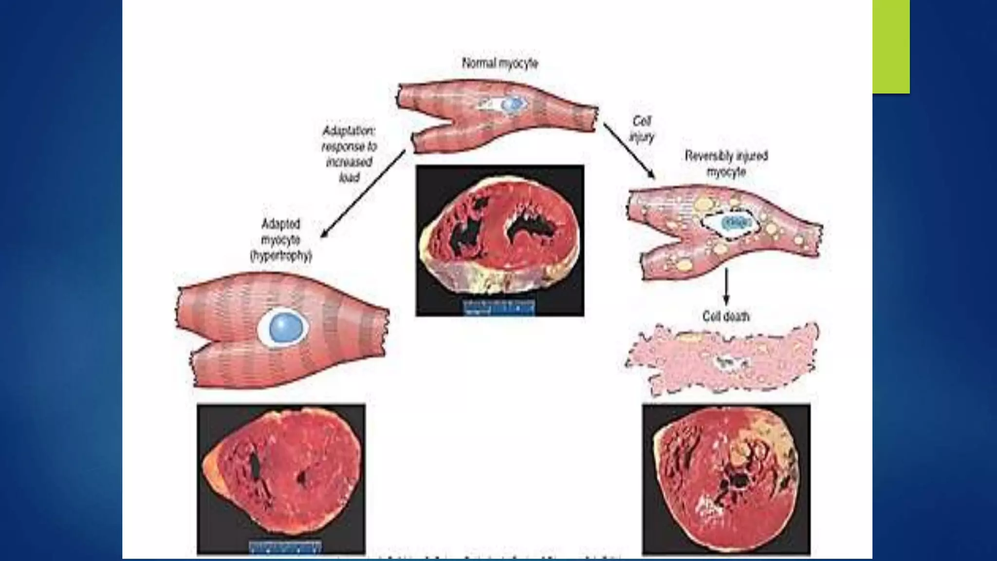 Cell injury and hypertrophy | PPTX