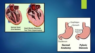Cell injury and hypertrophy | PPTX