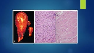 cellinjuryandhypertrophy pathology .pptx