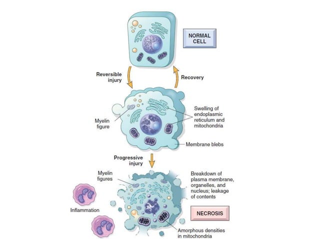 cell injury and necrosis mechanism Pathology.ppt