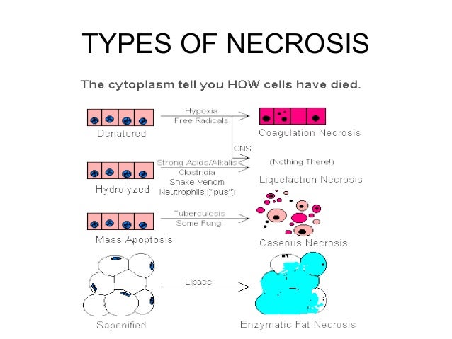 Cell injury, apotosis and necrosis(1)