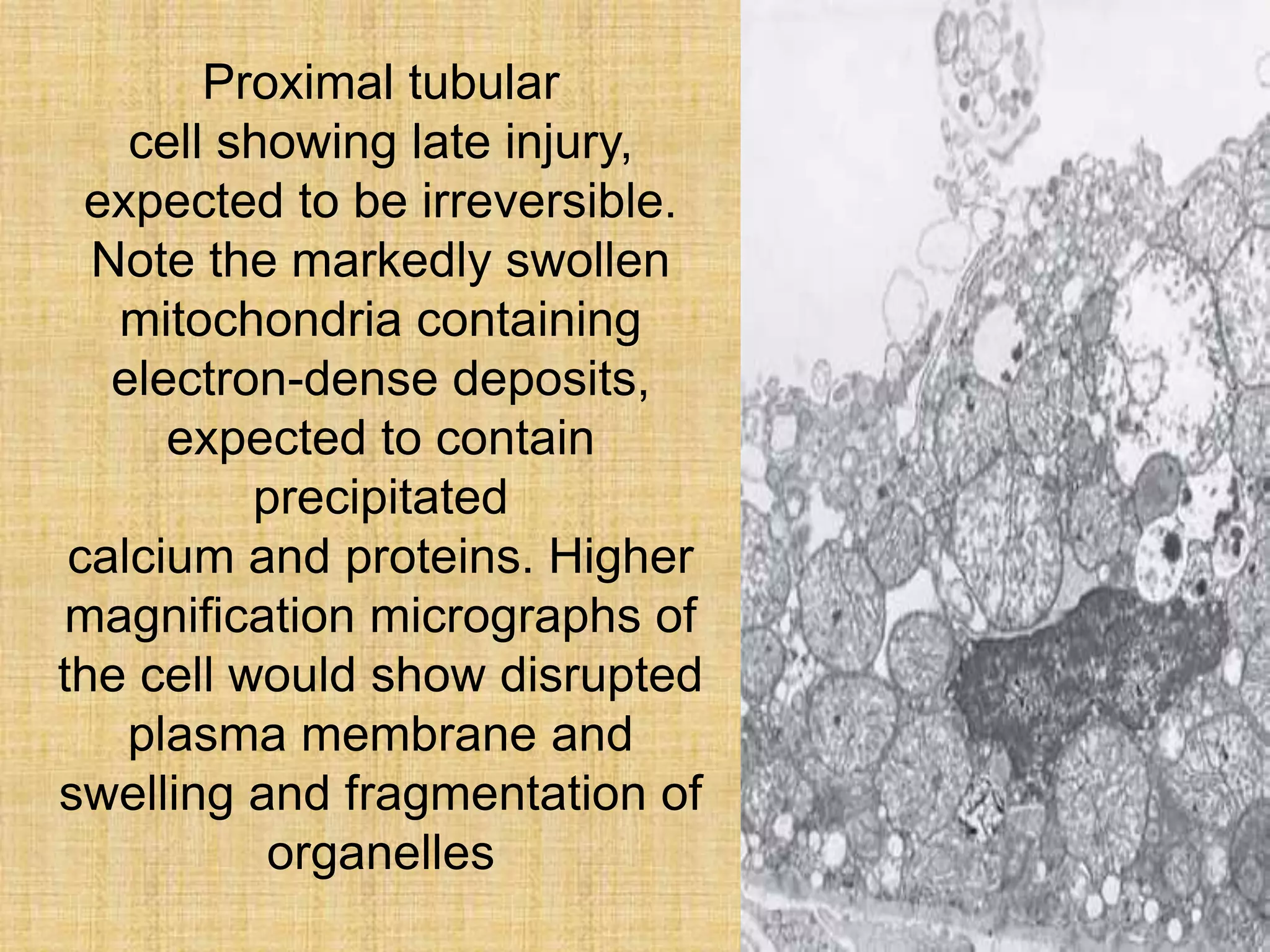 Cell injury causes and overview of cell injury and cell death lect 4 ...