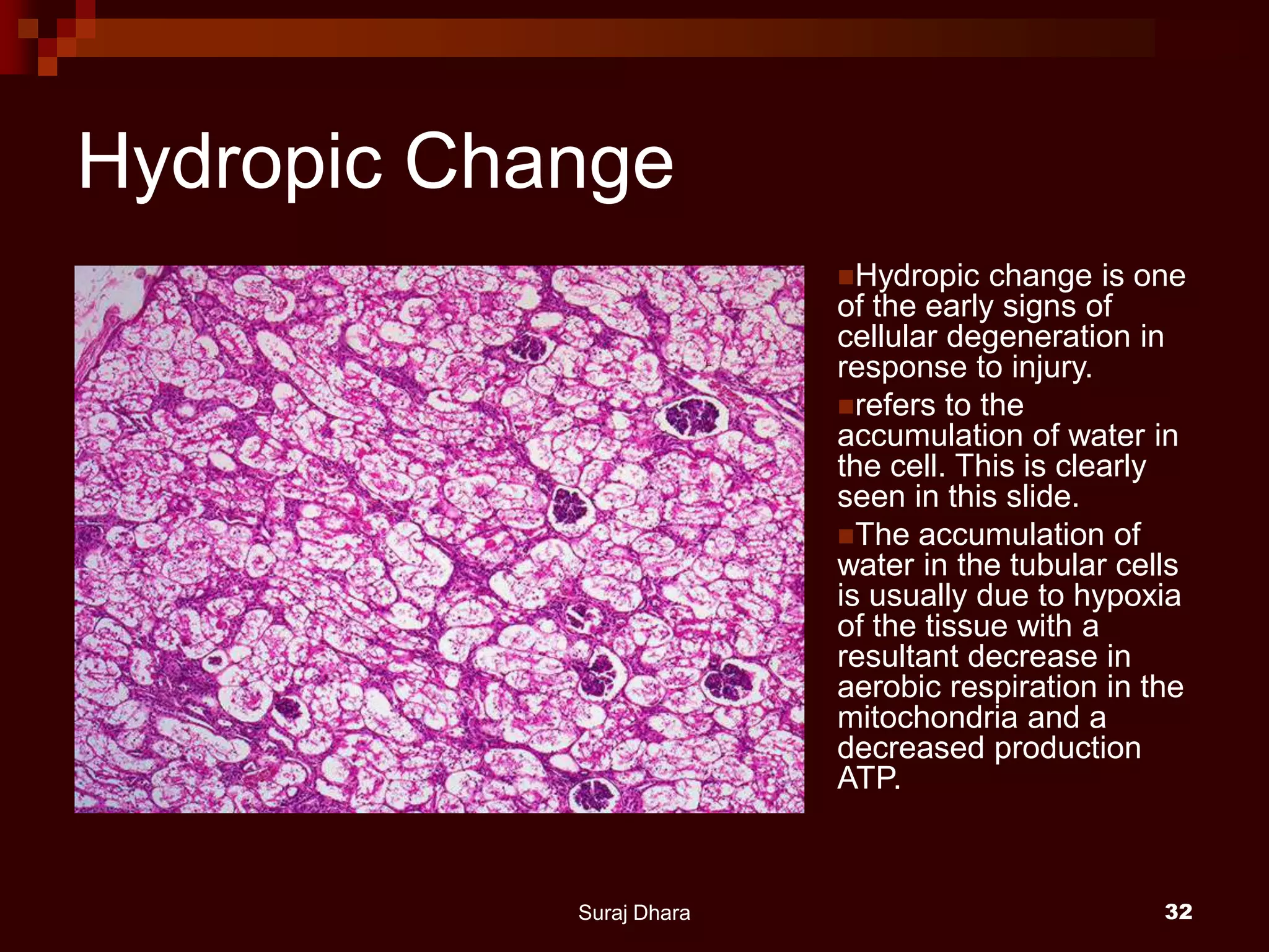 Cell injury & Cell death | PPTX