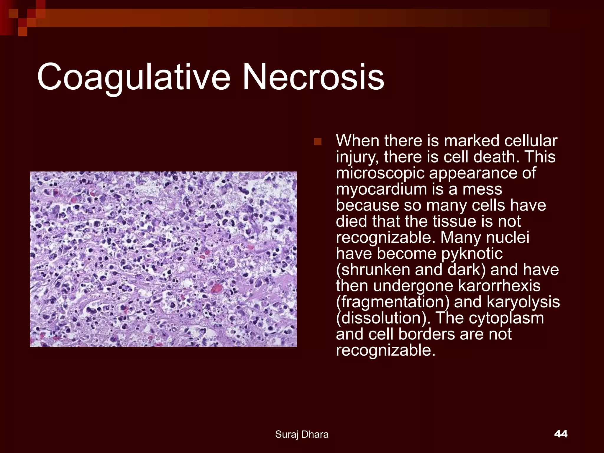 Cell injury & Cell death | PPTX