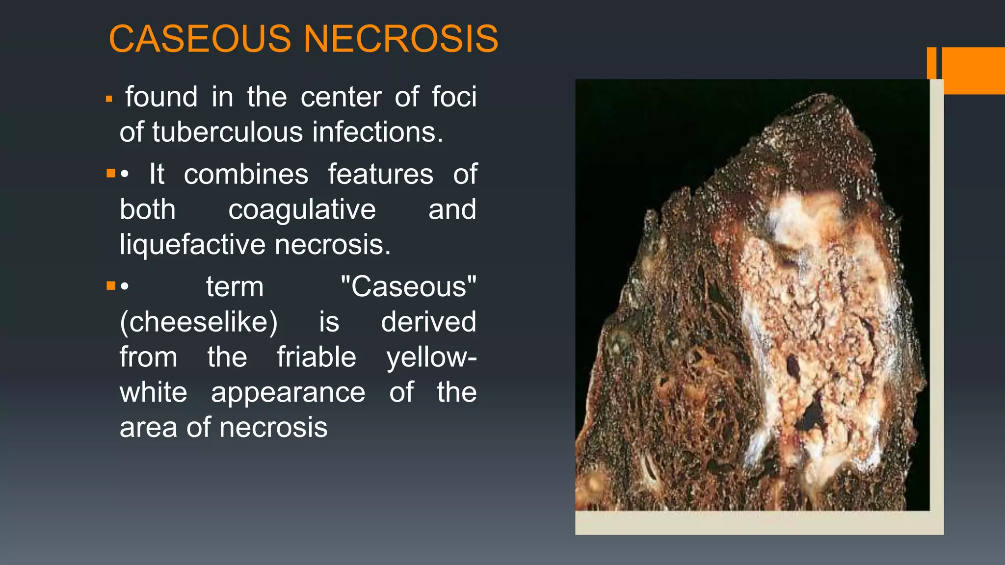 Cell injury cell swelling necrosis fatty change | PPTX
