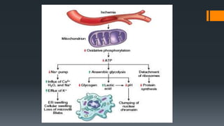 Cell injury cell swelling necrosis fatty change | PPTX