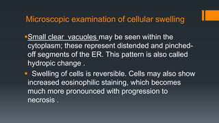 Cell injury cell swelling necrosis fatty change | PPTX
