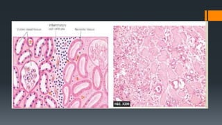 Cell injury cell swelling necrosis fatty change | PPTX
