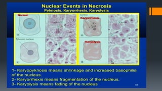 Cell injury cell swelling necrosis fatty change | PPTX