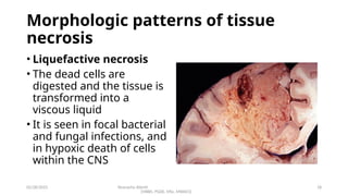 Histopathology: Cell injury, death and adaptation lecture-1 | PPT