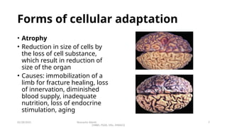 Histopathology: Cell injury, death and adaptation lecture-1 | PPT