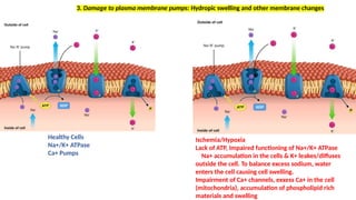 Cell_Injury_etiology and Pathophysiology.pptx