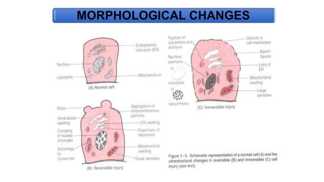 CELL INJURY | PPT