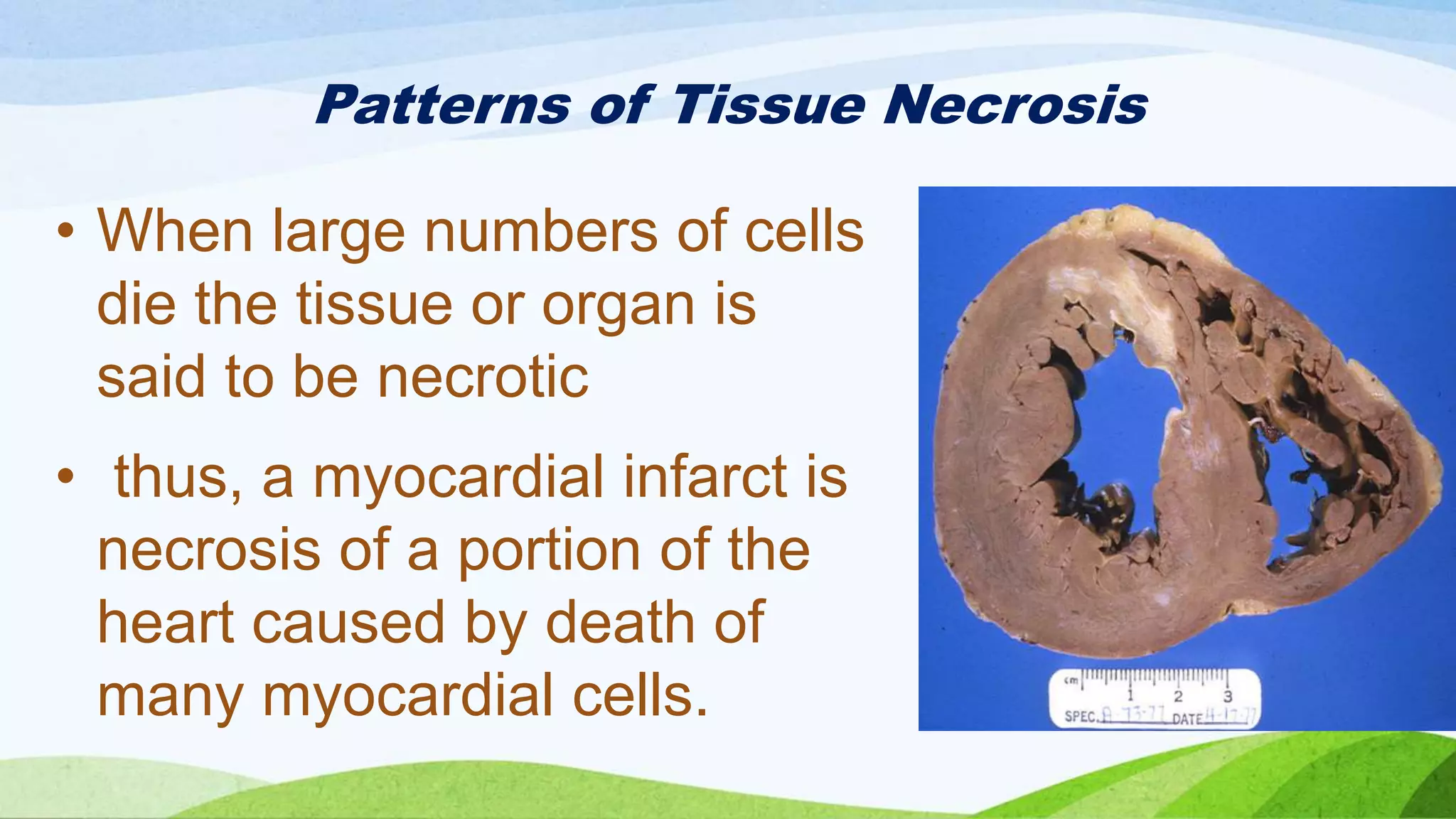 Cell injury