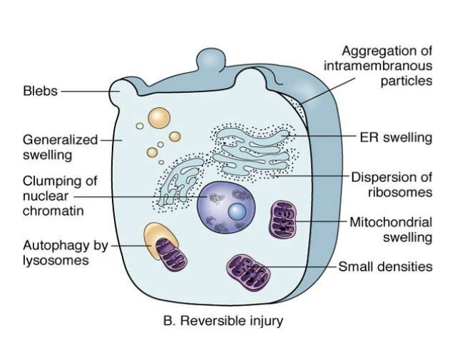Cell injury part 1