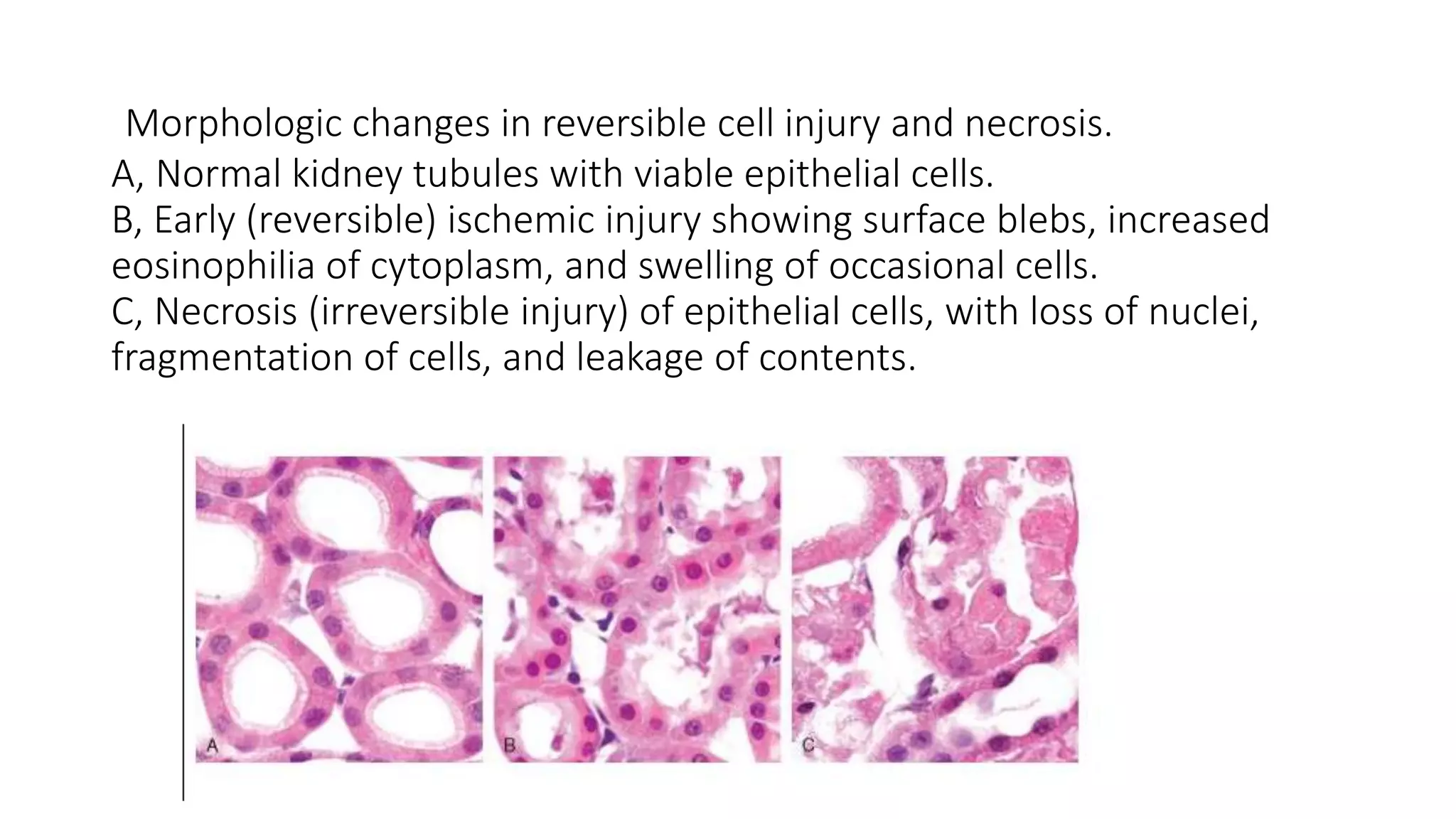 Cell injury pathology | PPTX