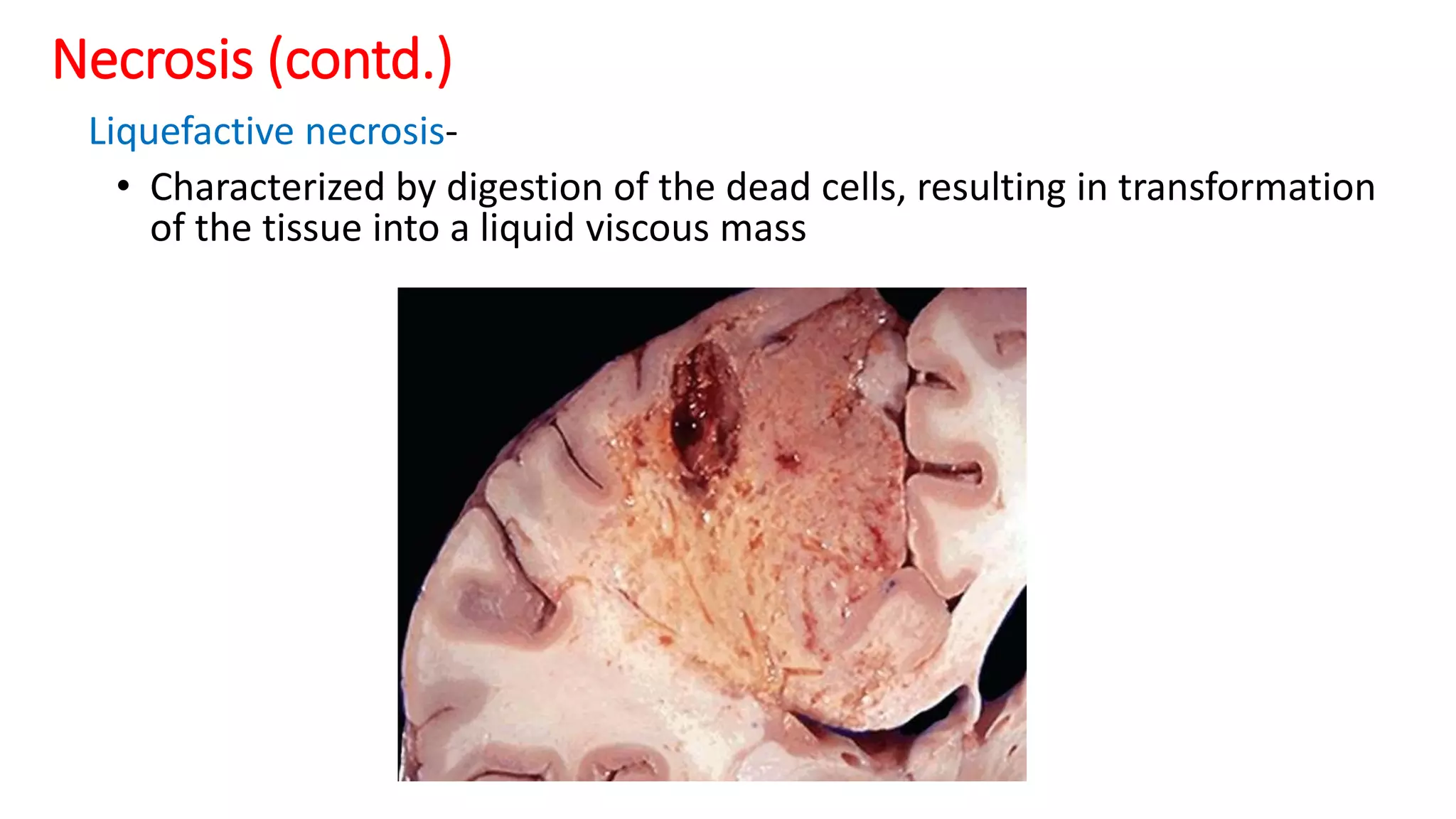 Cell injury pathology | PPTX
