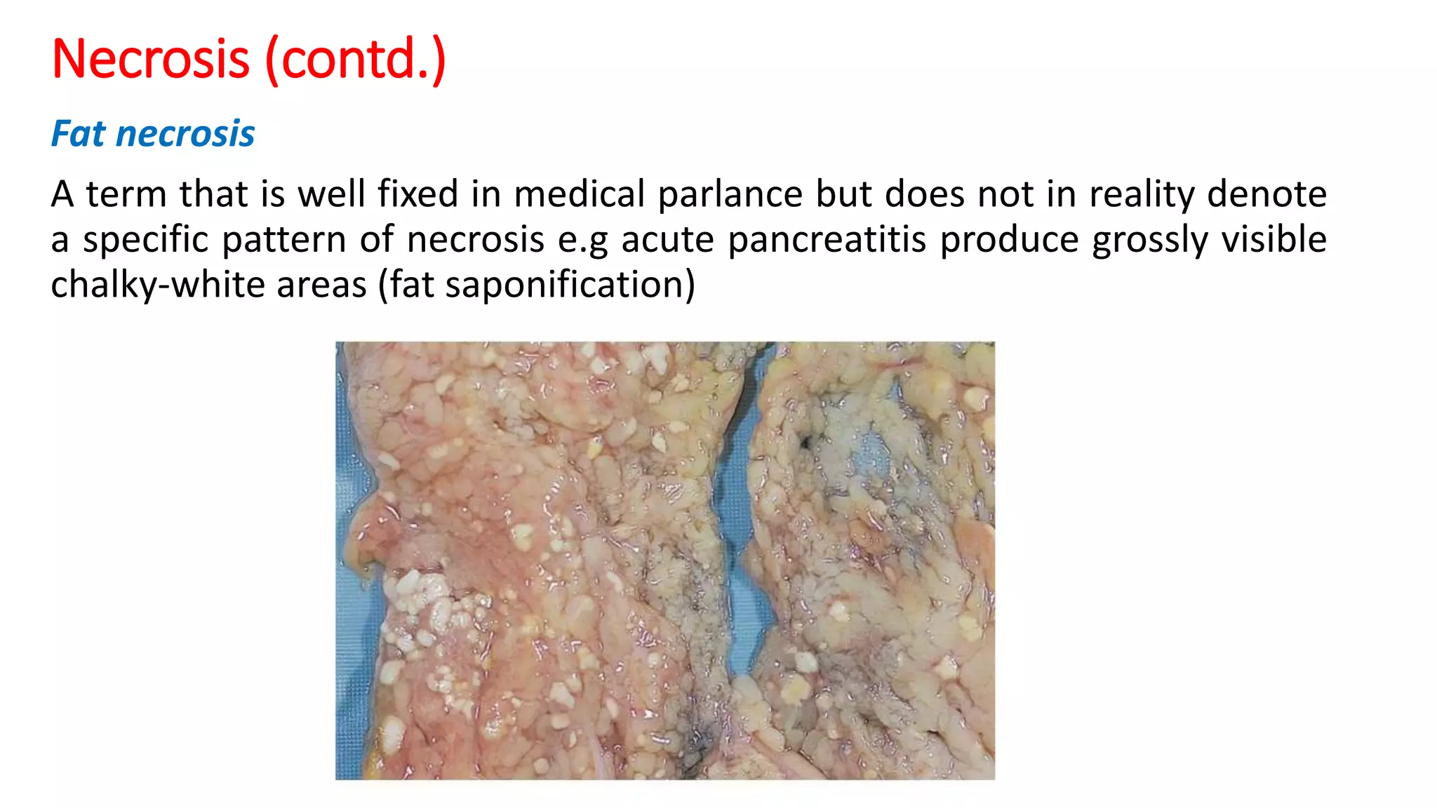 Cell injury pathology | PPTX
