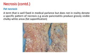 Cell injury pathology | PPTX
