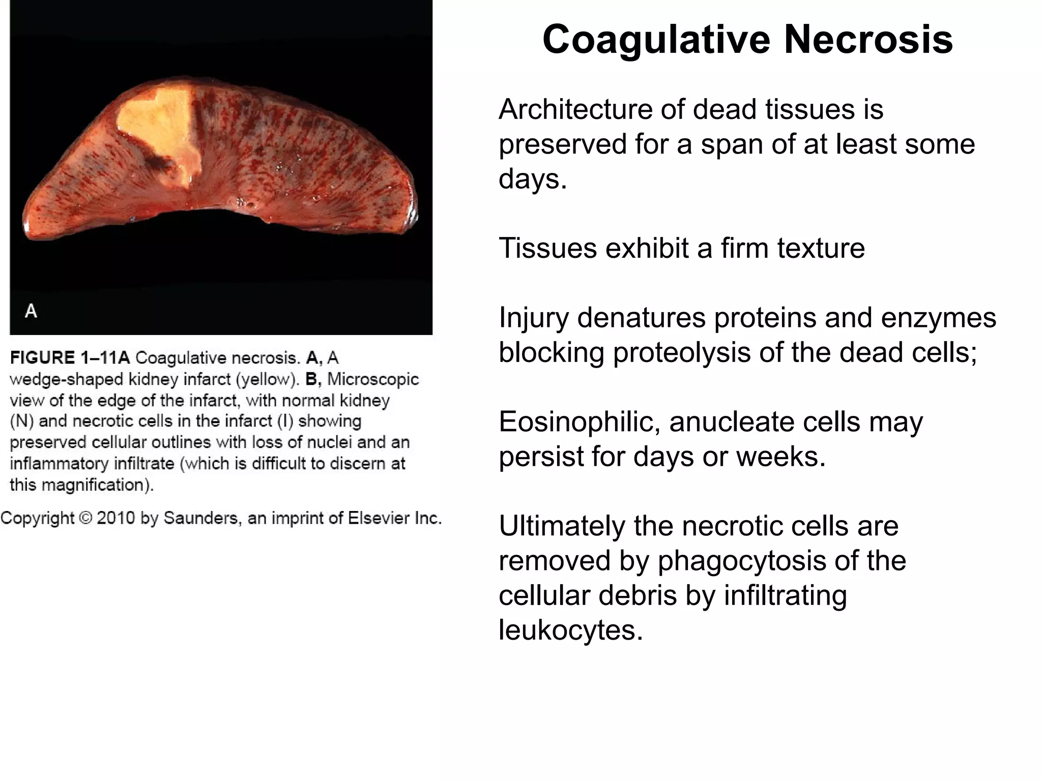 cell necrosis , apoptosis presentation.pdf