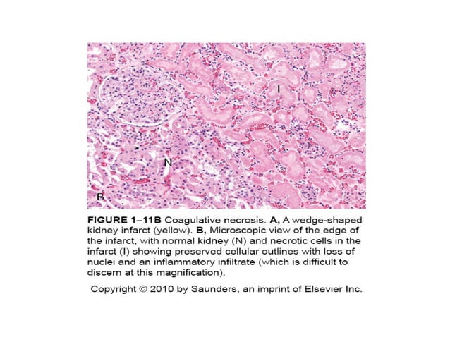 cell necrosis , apoptosis presentation.pdf