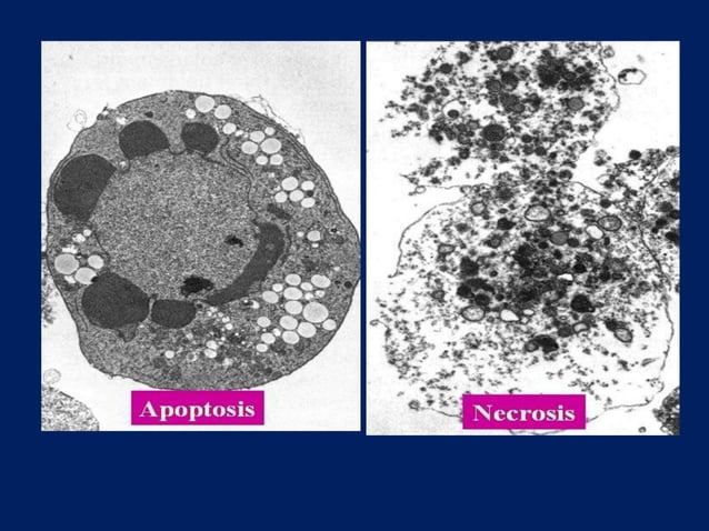 Cell senescence and Apoptosis (PCD) | PPSX