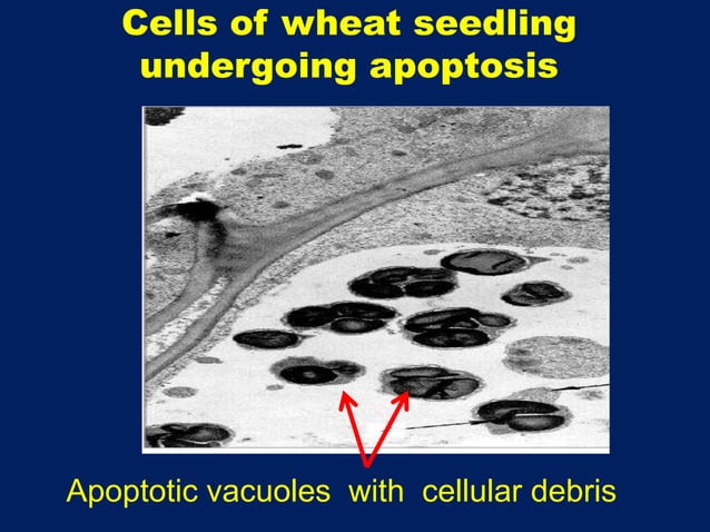 Cell senescence and Apoptosis (PCD) | PPSX