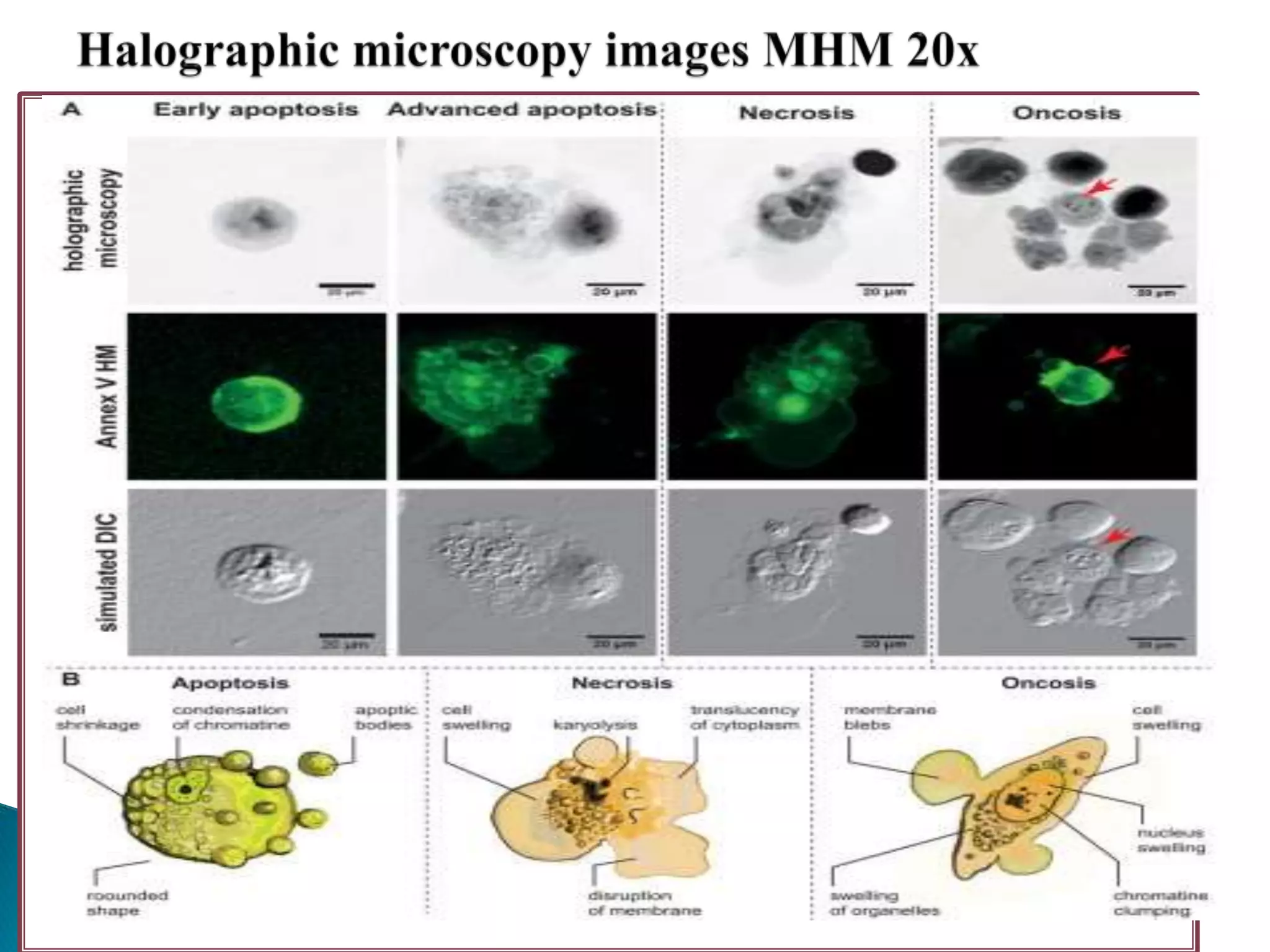 Cells undergoing morphological changes during apoptosis | PPTX