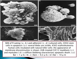 Cells undergoing morphological changes during apoptosis | PPTX