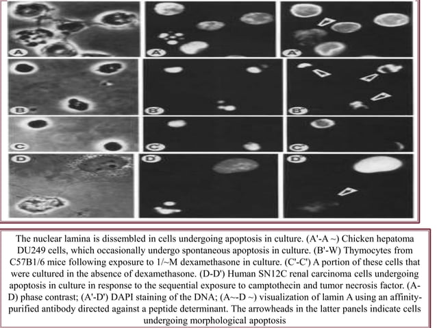Cells undergoing morphological changes during apoptosis | PPTX ...