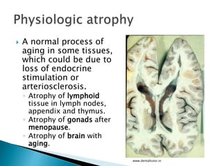 Cellular adaptation | PPTX