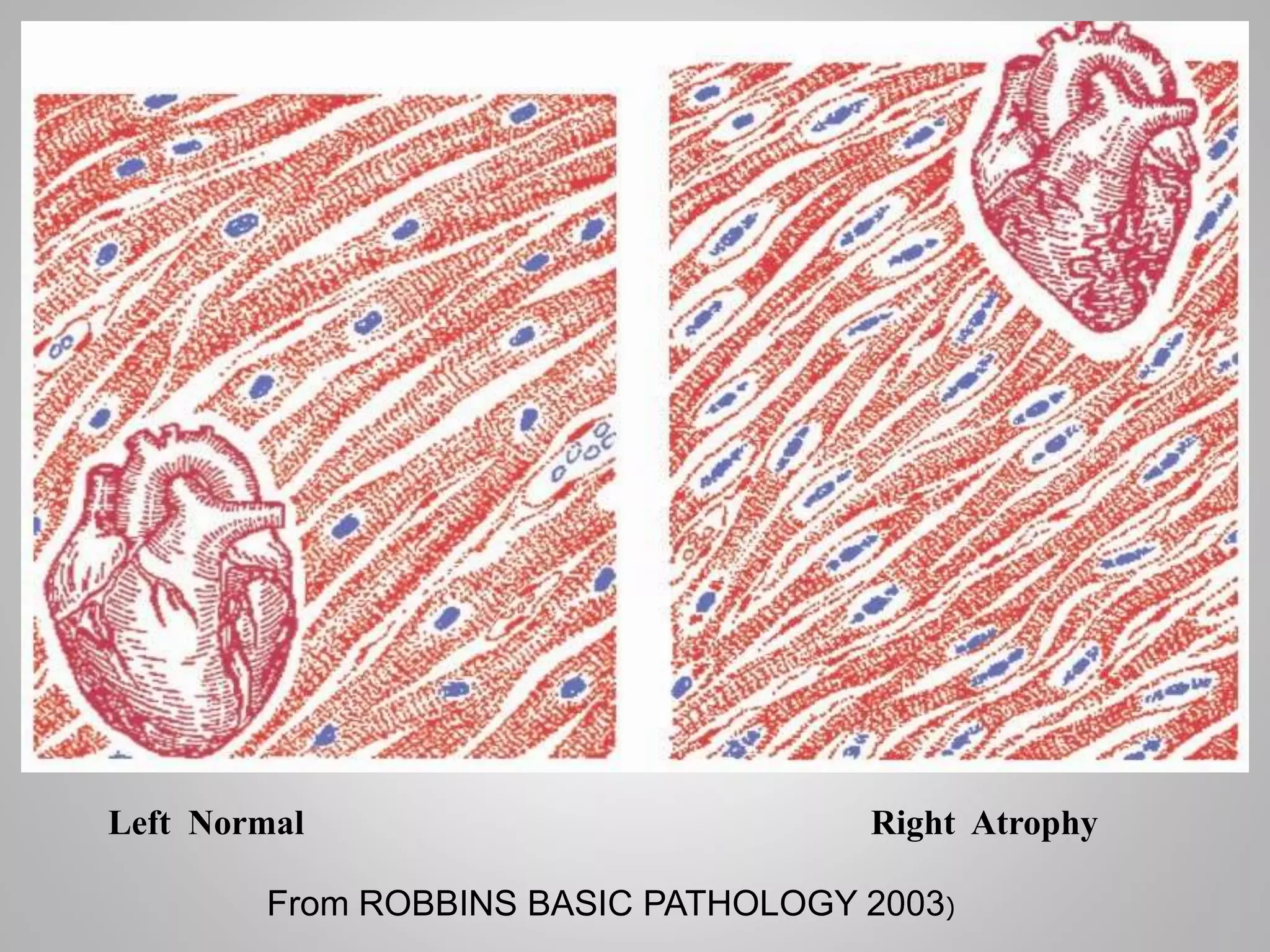 Cellular Adaptation & abbrent cell growth.pptx