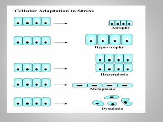 Cellular Adaptation & abbrent cell growth.pptx
