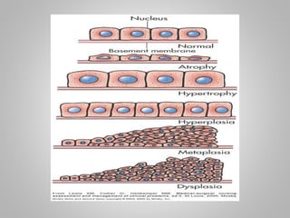 Cellular Adaptation & abbrent cell growth.pptx